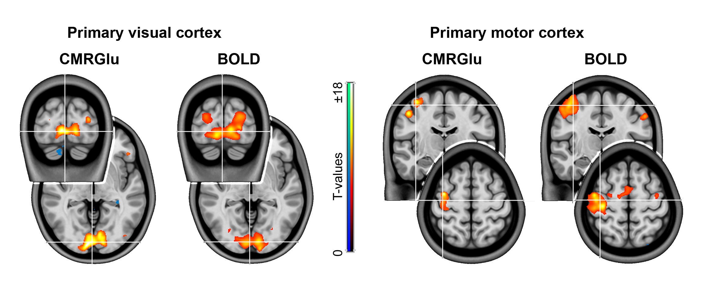 Functional, Molecular & Translational Neuroimaging Lab | Links