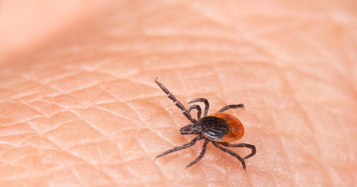 Zeckenspeichel verändert Immunreaktion von Hautzellen