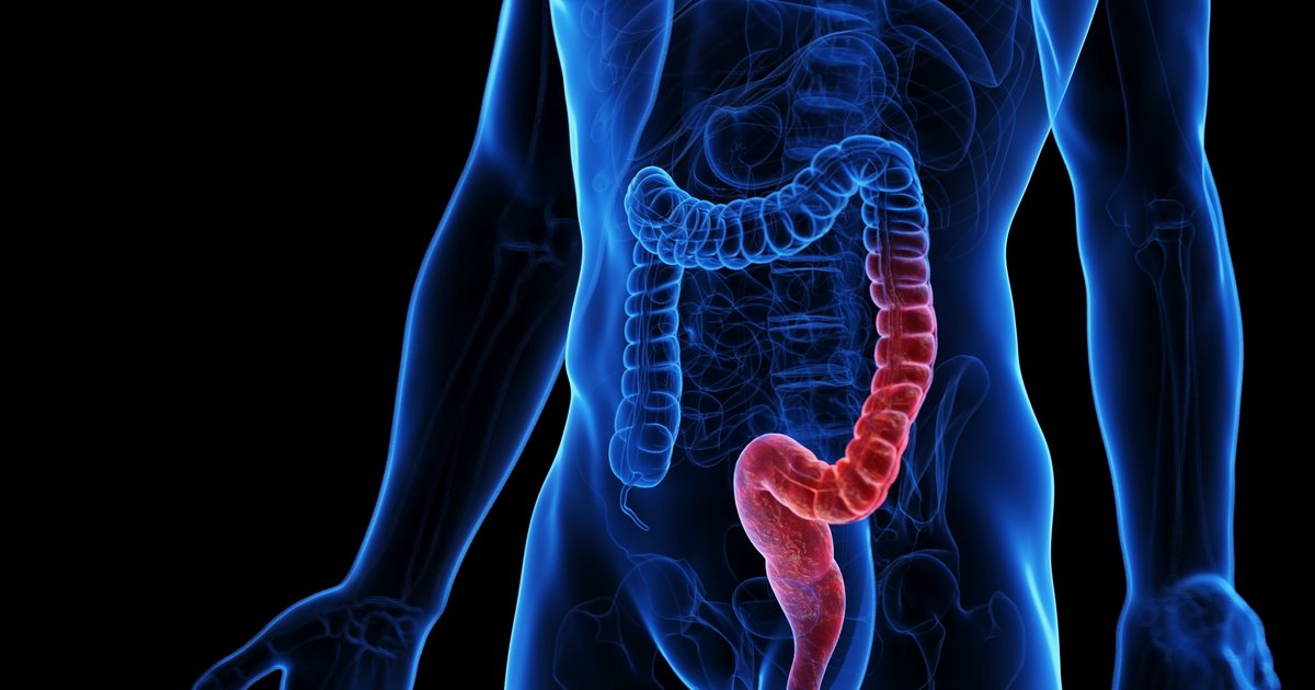 New approach to treating chronic inflammatory bowel disease