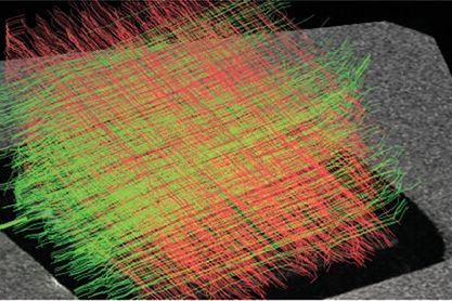 World's first high-resolution brain developed by 3D printer