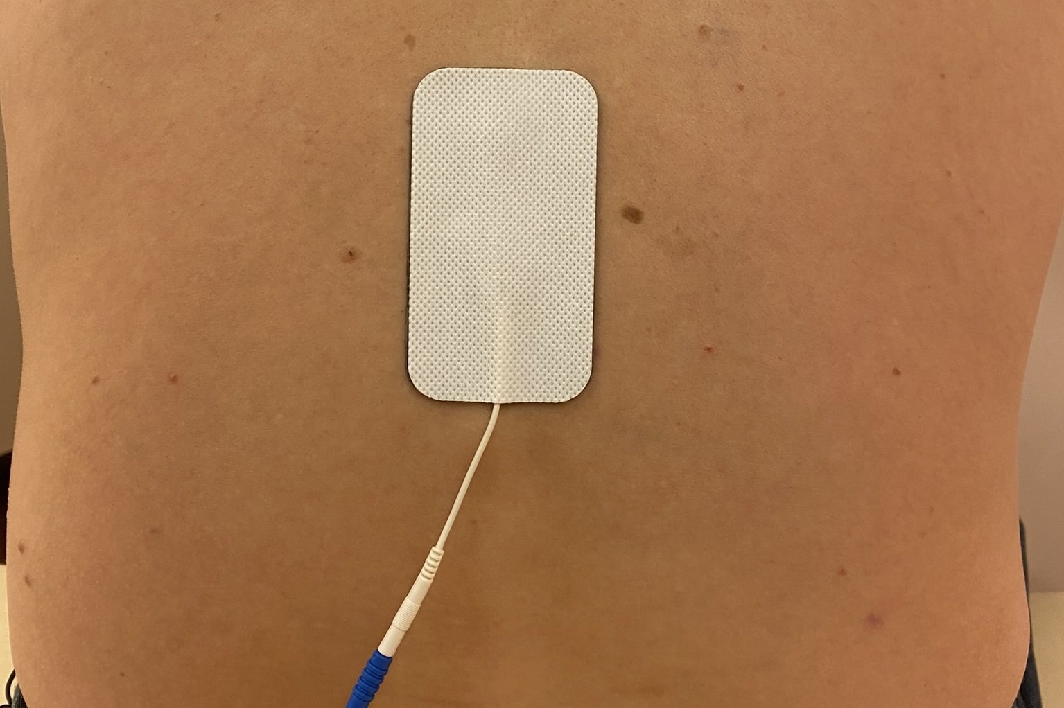 Key mechanisms of action of spinal cord stimulation unveiled