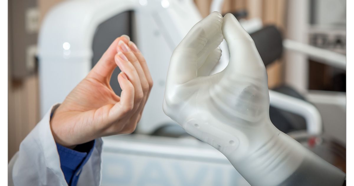„Plug and Play“: Weltweit erste sofort einsetzbare, bionische Arm ...