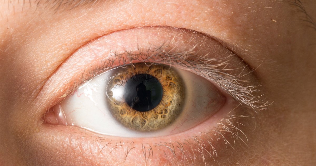 New prognostic marker discovered for multiple sclerosis severity